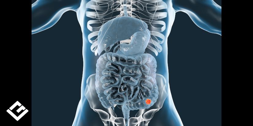 Direct Access Screening Colonoscopy | Gunnison Valley Health